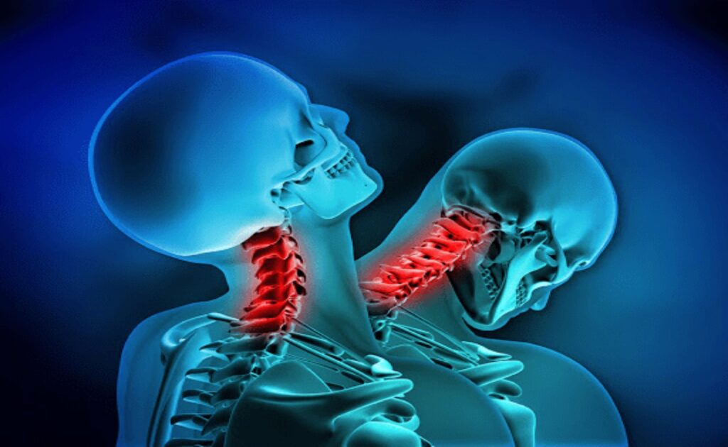 Whiplash Injury Physiotherapy Mississauga » Curezone Physiotherapy