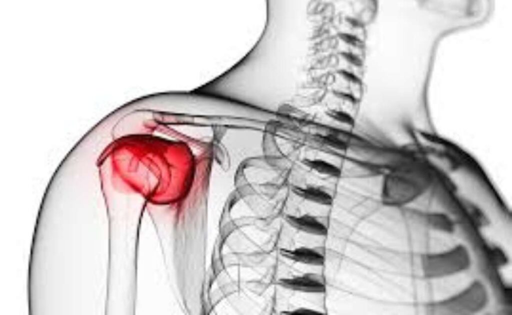 Rotator Cuff Tendinopathy For Shoulder Pain » Curezone Physiotherapy