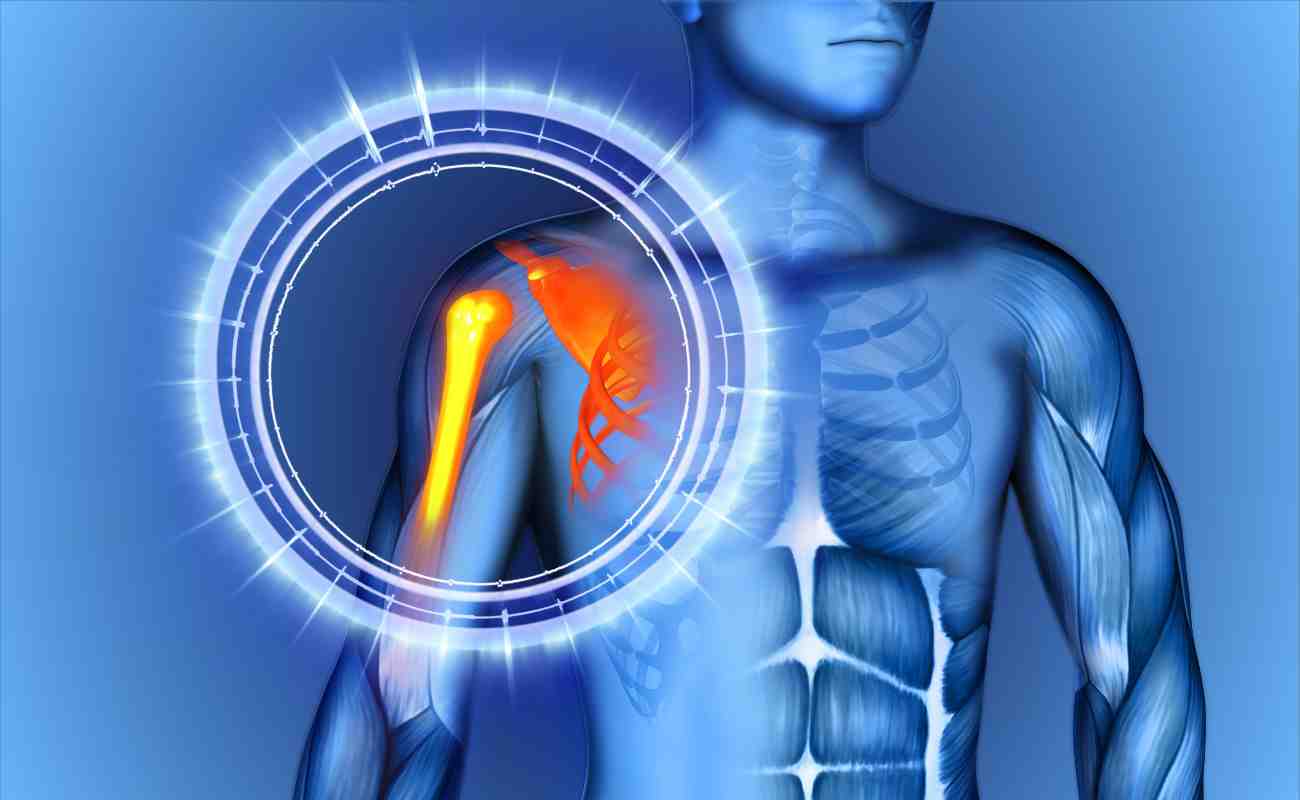 frozen Shoulder and Physiotherapy » Curezone Physiotherapy